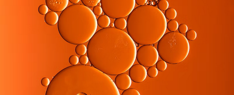 Treatment of Chest Sun Damage: Luminase and Exfolase Creams - Kare MD ...