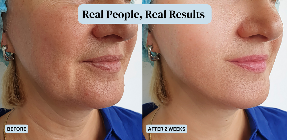 Kare MD Skin Health | Medical Skincare | Melarase PM Brightening Night ...