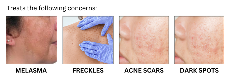 Kare MD Skin Health | Medical Skincare | Melarase AM Intensive Skin ...